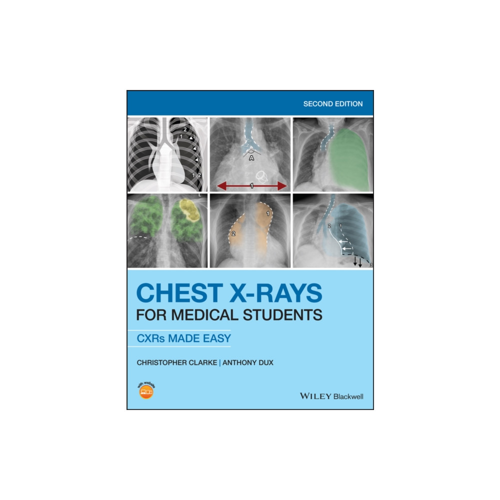 Köp Chest X-Rays for Medical Students (häftad, eng) online
