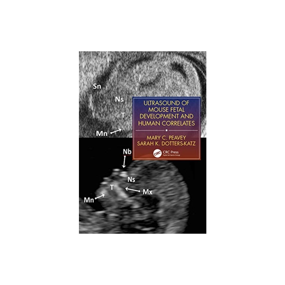 Köp Ultrasound of Mouse Fetal Development and Human Correlat...